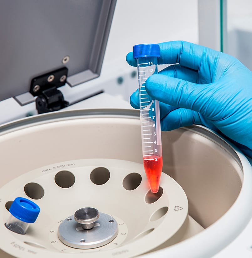 Congelamento do tecido ovariano: como funciona? - Profam